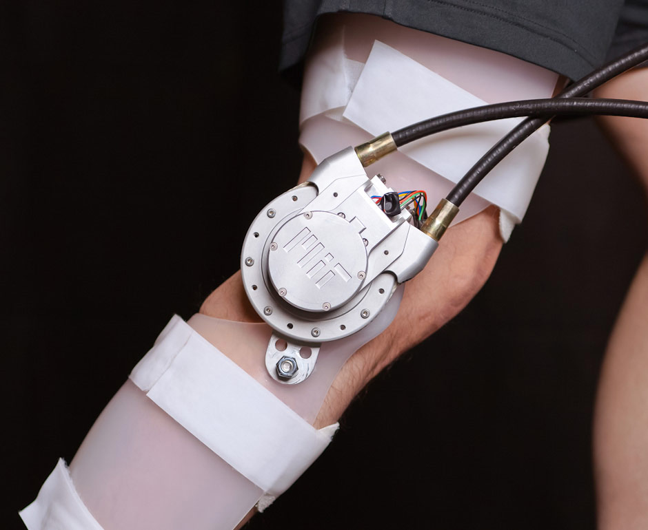 Biomechatronics – MIT Media Lab